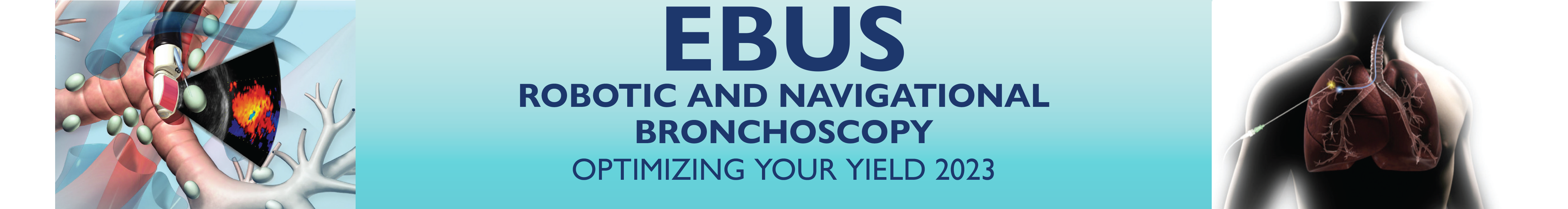 EBUS Robotic and Navigational Bronchoscopy: Optimizing Your Yield 2023 ...