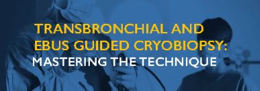 Transbronchial and EBUS Guided Cryobiopsy: Mastering the Technique ...